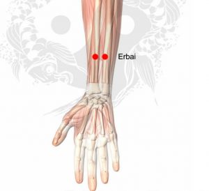 EX24 Erbai - Abalance